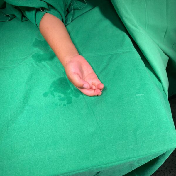 Outreach Hand Surgery - Dr David Graham Hand